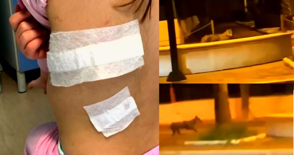 Vasto, allarme animali selvatici: bimba aggredita da un lupo, ferita ...